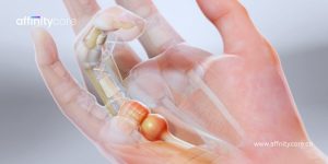 CPT Code 26055: Procedures, Modifiers, and Reimbursement